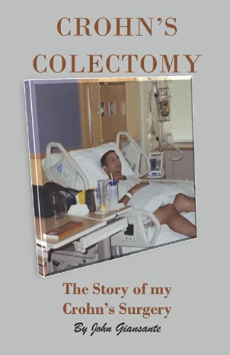 CROHN’S COLECTOMY: The Story of my Crohn's Surgery: Giansante, John R ...