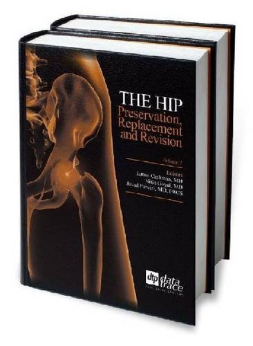Buy The Hip: Preservation, Replacement and Revision Book Online at Low ...