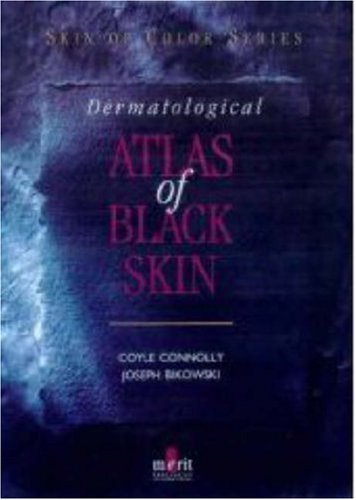 Dermatological Atlas of Black Skin: Connolly, Coyle, Bikowski, Joseph ...