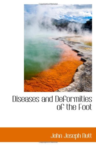 Diseases and Deformities of the Foot: Amazon.co.uk: Nutt, John Joseph ...