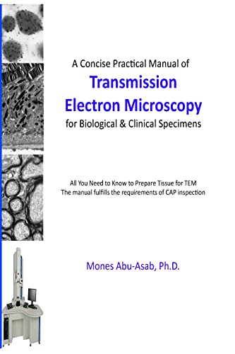 Transmission Electron Microscope Specimens