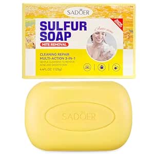 Amazon.com : Princess Belle Sulphur Soap Bar, Sulfur Soap for Acne, Sulfur Body Wash for Gentle ...