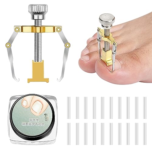 Mejores herramientas uñas encarnadas baratas ️ 2025