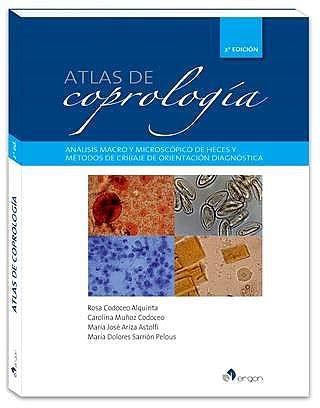 Amazon.com: Atlas de Coprología. 2ª edición: Análisis macro y ...
