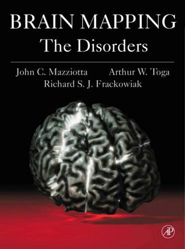 Brain Mapping: The Disorders: 9780124814608: Medicine & Health Science ...