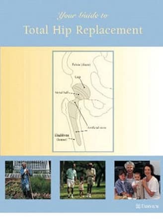 Amazon.com: Your Guide to Total Hip Replacement: 9781577491644 ...