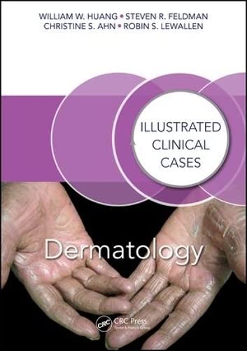 Dermatology: Illustrated Clinical Cases: 9781498722889: Medicine ...