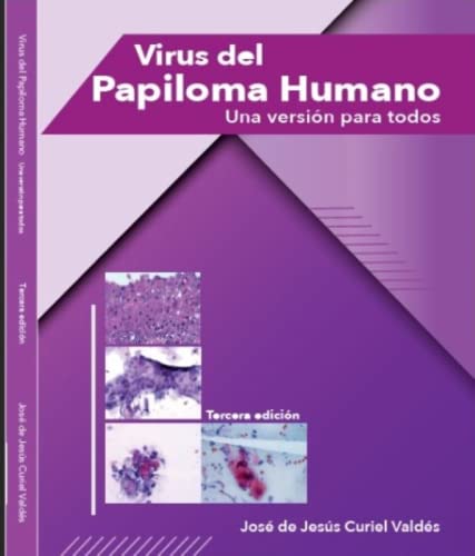 Amazon.com.br eBooks Kindle: Virus del Papiloma Humano : Una Versión ...