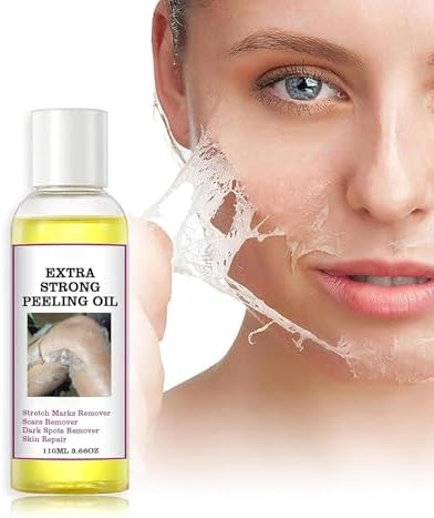 Amazon.com: Extra Strong Peeling Oil, Chemical Exfoliant For Face Body ...