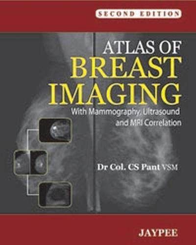 Atlas of Breast Imaging: With Mammography, Ultrasound and MRI ...