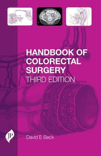 Handbook of Colorectal Surgery: Third Edition: 9781907816208: Medicine ...