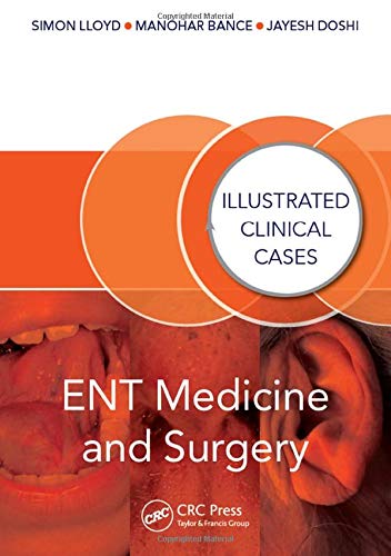 ENT Medicine and Surgery: Illustrated Clinical Cases: 9781138091481 ...