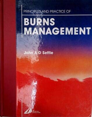 Principles And Practice Of Burns Management: SETTLE, JOHN ...
