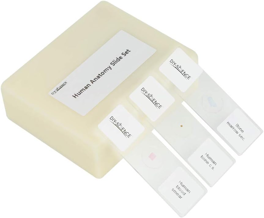 Amazon.com: Human Blood Smear Microscope Slides, H&E Stain, Pack of 5 ...