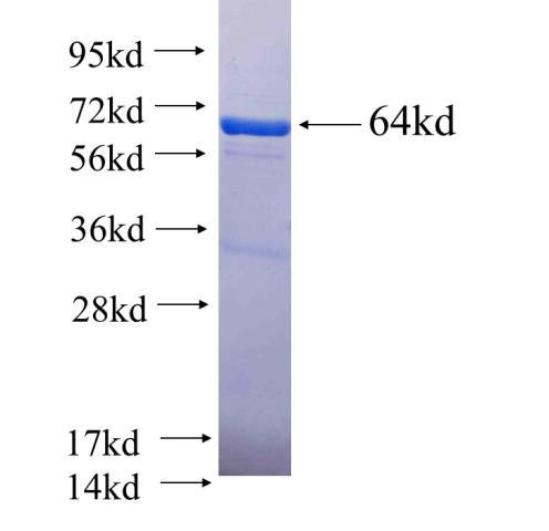 Amazon.com: Human FDPS Fusion Protein : Industrial & Scientific