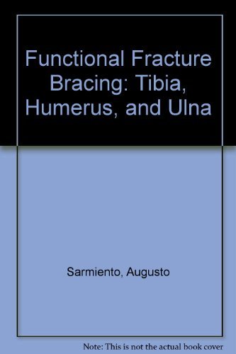 Functional Fracture Bracing: Tibia, Humerus, and Ulna | Amazon.com.br