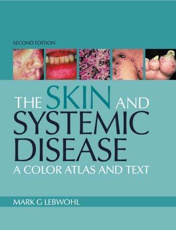 The Skin and Systemic Disease: A Color Atlas and Text: 9780443065392 ...