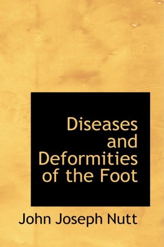 Diseases and Deformities of the Foot: Nutt, John Joseph: 9781103865659 ...
