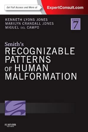 Smith's Recognizable Patterns of Human Malformation: Expert Consult ...