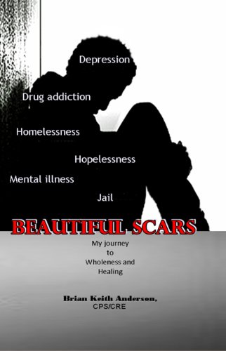 Amazon.com: Beautiful Scars eBook : Anderson, Brian: Kindle Store