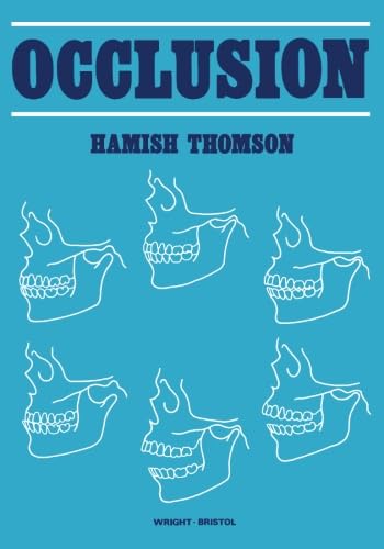Amazon.com: Occlusion: 9781483250175: Thomson, Hamish: Books