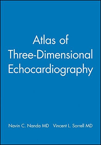 Amazon.com: Atlas of Three-Dimensional Echocardiography eBook : Nanda ...