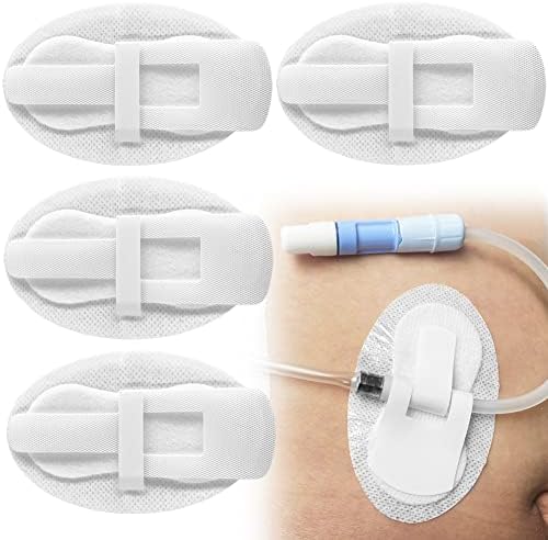 Amazon.com: Feeding Tube Pads for Peritoneal Dialysis Peg/G/J Tube ...