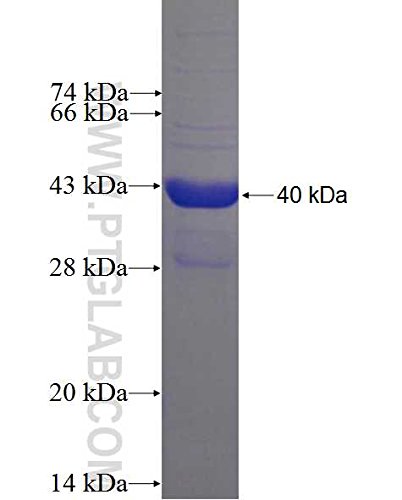 Amazon.com: Human MAP1LC3A,LC3 Fusion Protein : Industrial & Scientific