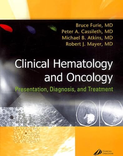 Clinical Hematology and Oncology: Presentation, Diagnosis and Treatment ...