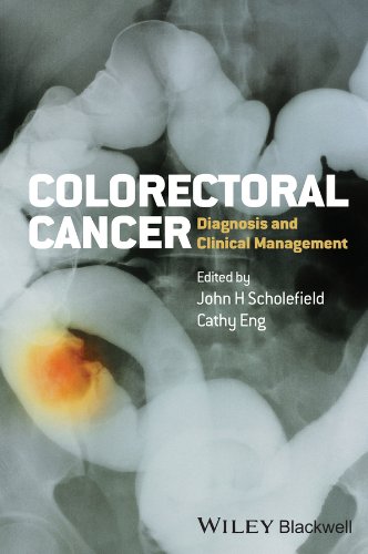 Amazon.com: Colorectal Cancer: Diagnosis and Clinical Management eBook ...