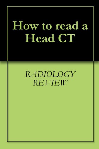 How to read a Head CT eBook : REVIEW, RADIOLOGY: Amazon.co.uk: Books