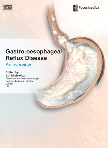 Gastro-oesophageal Reflux Disease (GORD) or GERD: An Overview ...
