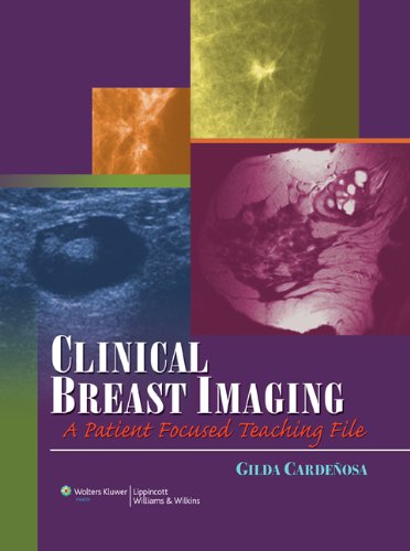 Clinical Breast Imaging: A Patient Focused Teaching File: 9780781762670 ...
