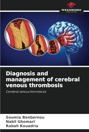 Buy Diagnosis and management of cerebral venous thrombosis Book Online at Low Prices in India ...
