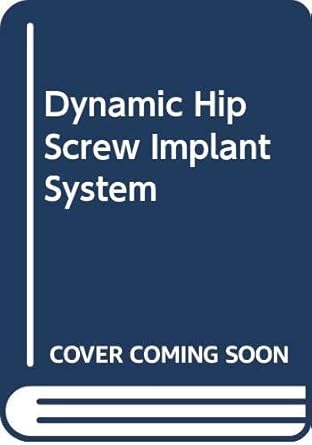 Dynamic Hip Screw Implant System : Amazon.com.tr: Kitap