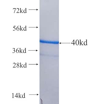 Amazon.com: Human ALMS1 Fusion Protein : Industrial & Scientific