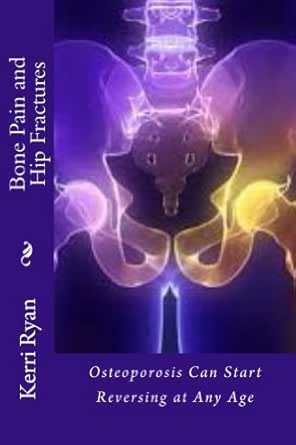 Bone Pain and Hip Fractures (Bones Book 1) - Kindle edition by Ryan ...