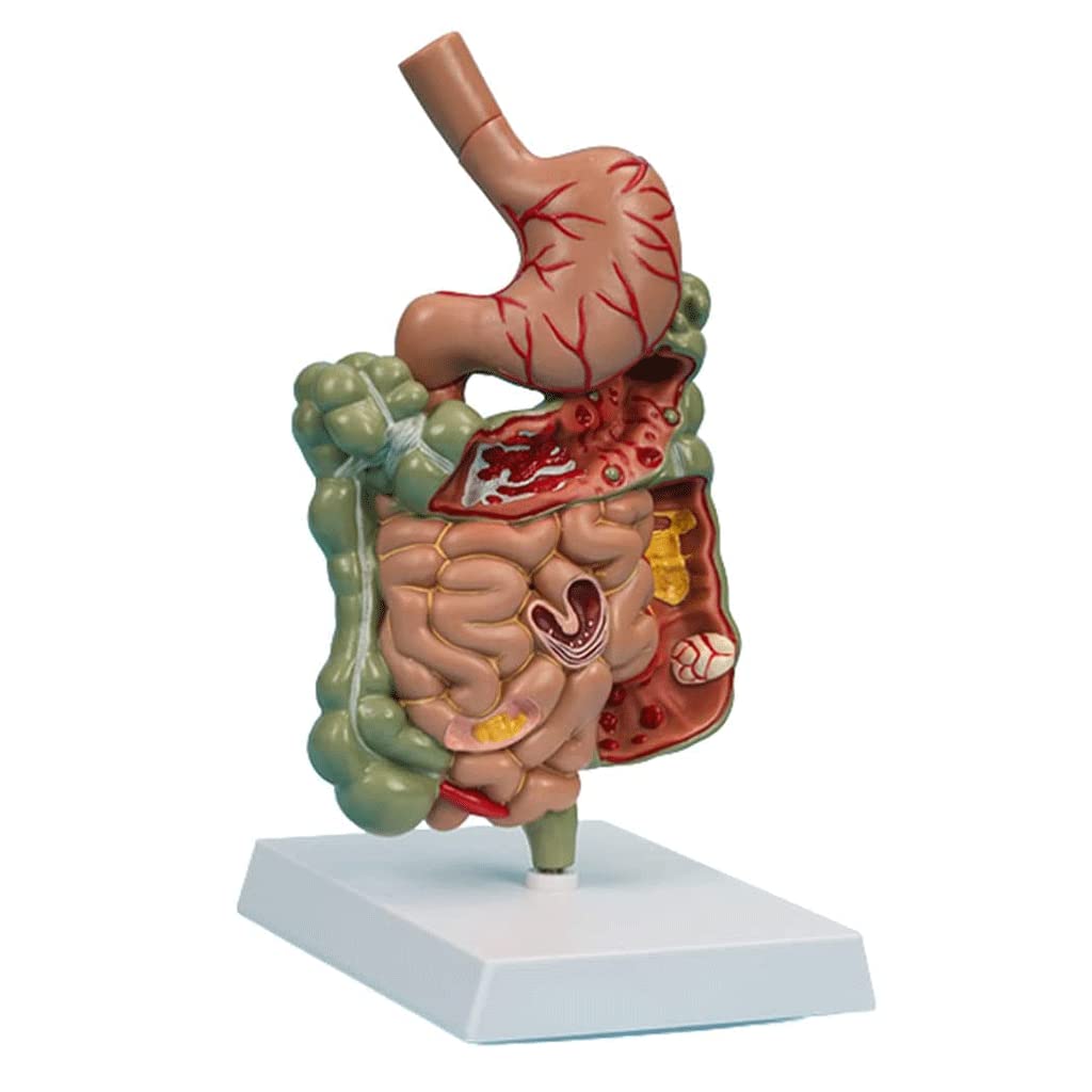 Small Intestine Anatomy Model