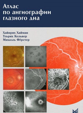 Buy Atlas of fundus angiography Trans. from English. / Atlas po ...