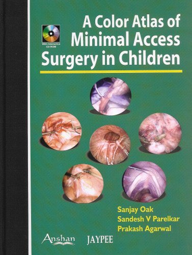 Amazon | Color Atlas of Minimal Access Surgery in Children | Oak ...