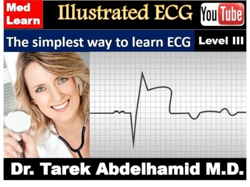 Illustrated ECG - Level III: The simplest way to learn ECG | Amazon.com.br