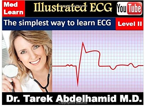 Buy Illustrated ECG - Level II: The simplest way to learn ECG Book ...