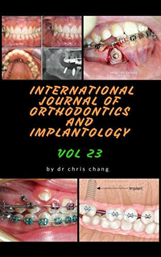 International Journal Of Orthodontics and Implantology Vol 23 eBook ...