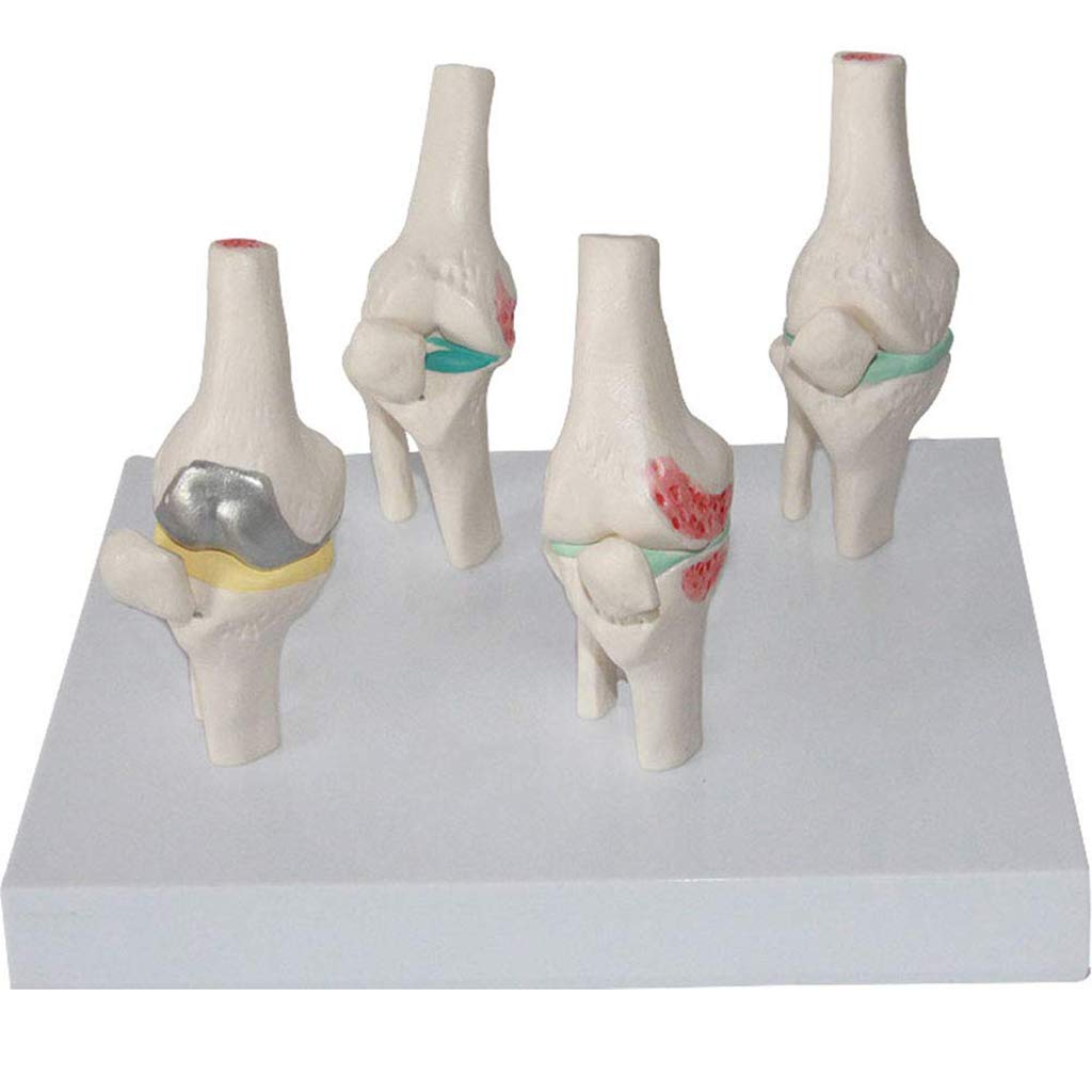 Buy FXQ Human Joint Model-PVC Human Knee Joint Anatomical Model -Howing ...