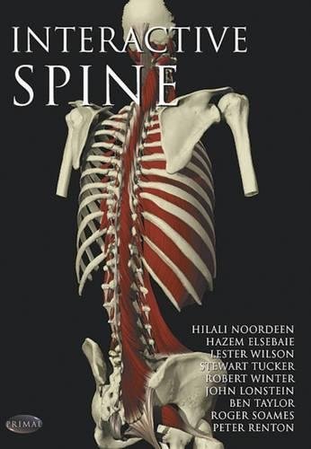 Interactive Spine (CD-ROM for Windows and Macintosh): 9781902470320 ...