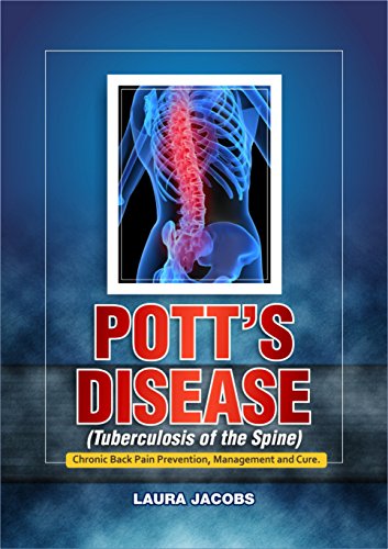 Amazon.com: Pott's Disease (Tuberculosis of the Spine): Chronic Back ...