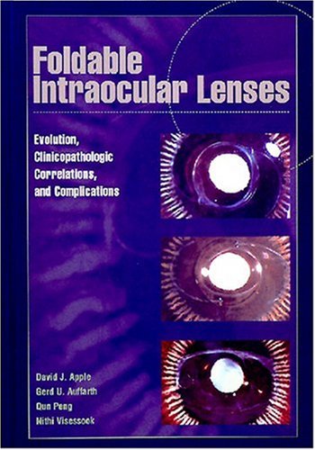 Foldable Intraocular Lenses: Evolution, Clinicopathologic Correlations ...