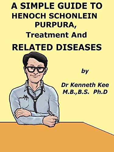 A Simple Guide to Henoch Schonlein Purpura, Treatment and Related ...