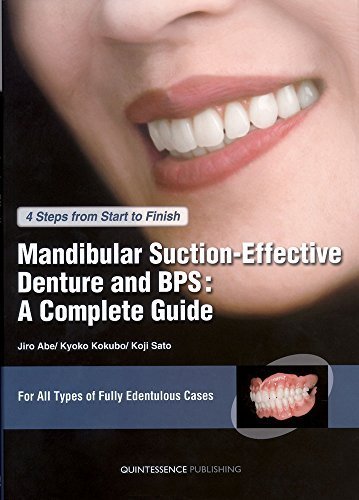 Amazon.in: Buy Mandibular Suction-Effective Denture and BPS: A Complete ...