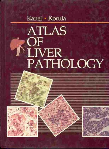 Atlas of Liver Pathology (Atlases in Diagnostic Surgical Pathology ...